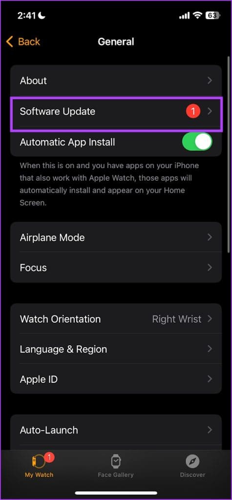 10 Ways to Fix Apple Watch Always On Display Not Working - Guiding Tech